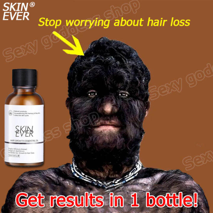 Drop by Drop,Rapid hair growth!SKIN EVER Hair growth Essential Oil 30ml ...