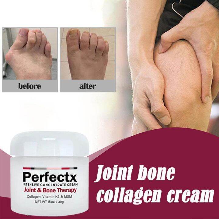 Perfectx Osteoarthritis Cream 30g For Gout, Arthritis, Varicose Veins ...