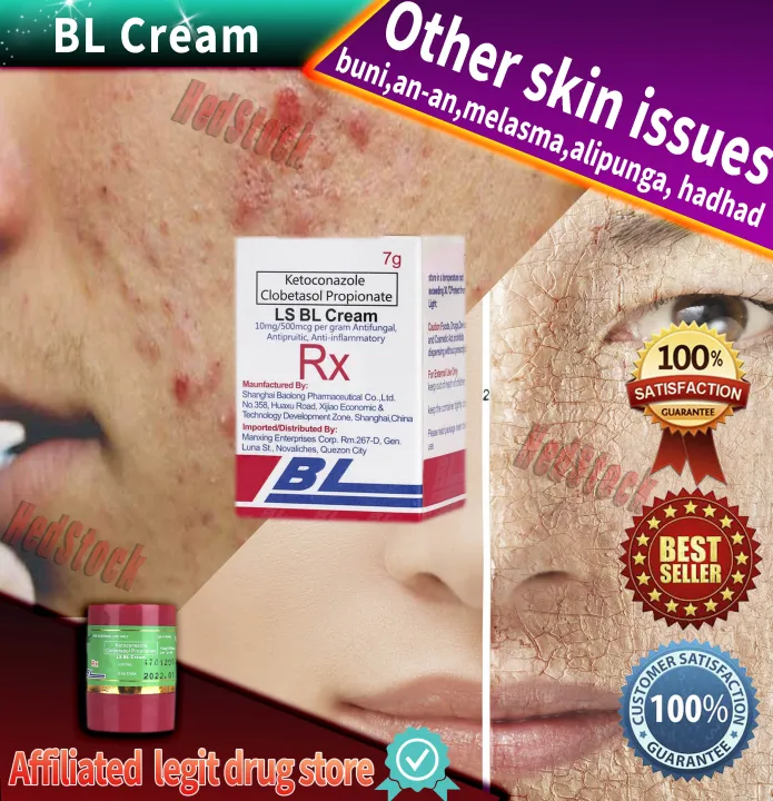 Cream For Anan Buni Alipunga hadhad / melasma Skin Dry issues ...