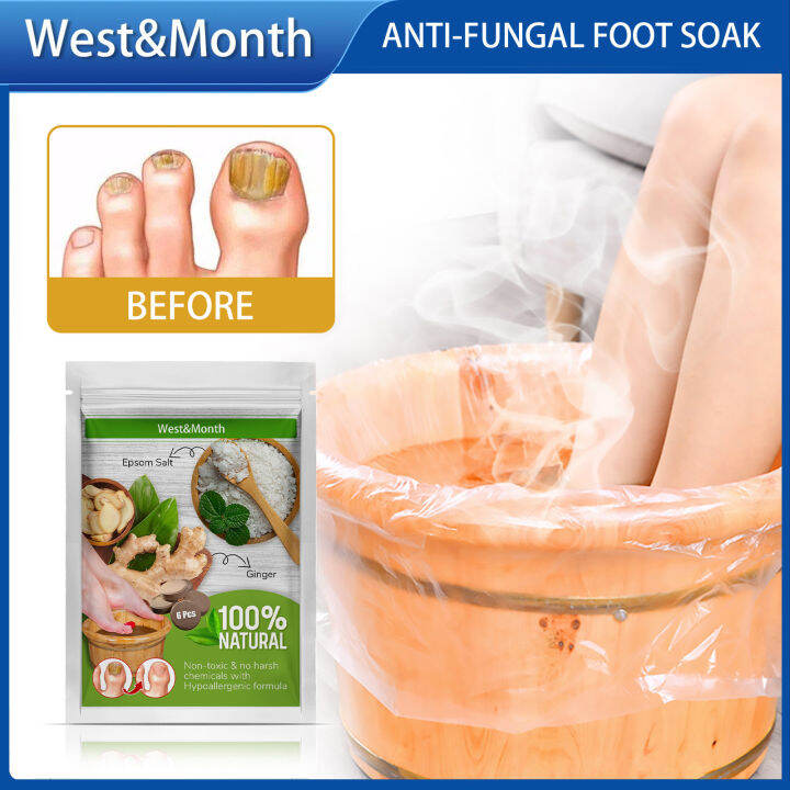 West Month Anti-Fungal Foot Soak Foot Bath Tablets Fungal Infections ...