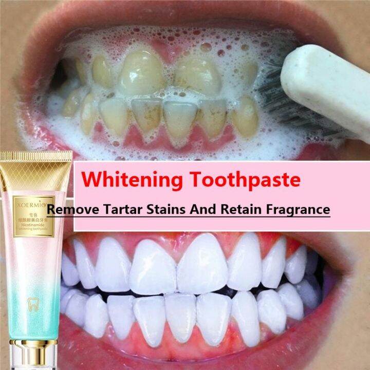 Whitening Toothpaste For Fresh Breath Remove Tartar Stains And Retain ...