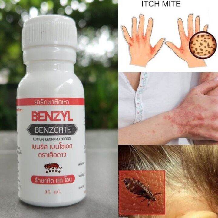 1 Bottle SCABIES TREATMENT LOTION MITE & LICE effective 30ml | Lazada.co.th