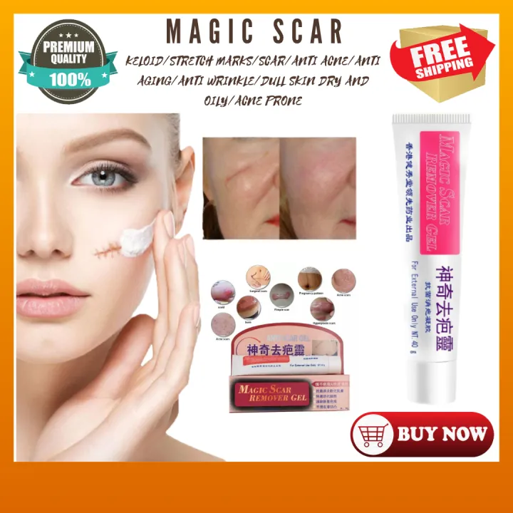 Original Magic Scar Remover Cream MEGASALE 👙 Repair Scar Removal ...
