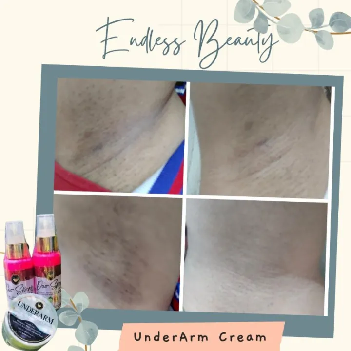 UNDERARM WHITENING CREAM BY HBS | Lazada PH