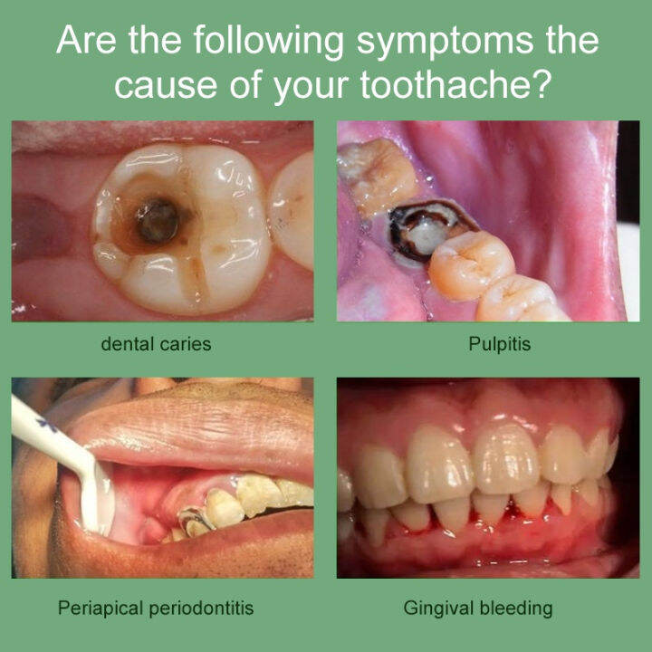 Oral Spray Toothache Reliever Pain Relief Oral Care Relief Teeth Worms ...