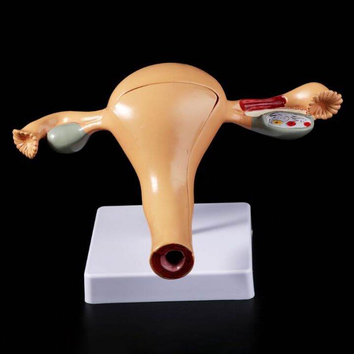 Pathological Uterus Ovary Anatomical Model Anatomy Cross Section Study ...