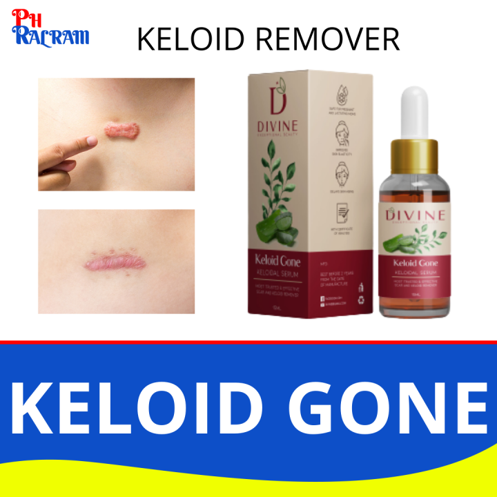 DIVINE EXCEPTIONAL BEAUTY 100% Organic Keloid Gone | Keloidal Serum ...