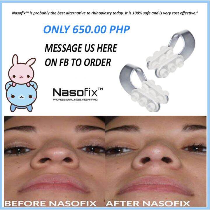 Nasofix nose reshapinguQm | Lazada PH