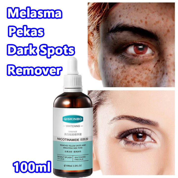 Melasma and pekas remover original serum melasma removal bleaching cream original authentic Dark ...
