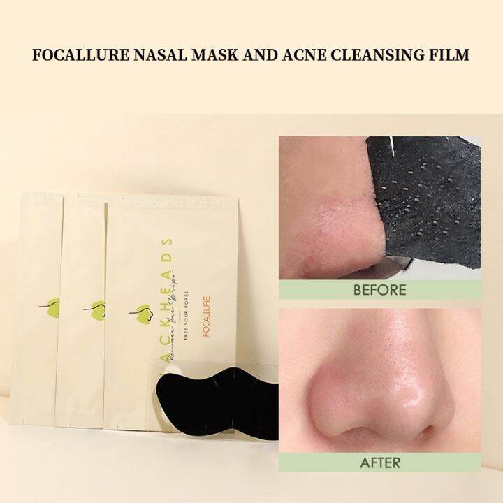 🔥dream Poem👍blackhead Remover Strips Deep Cleansing Nose Pore Cleaner