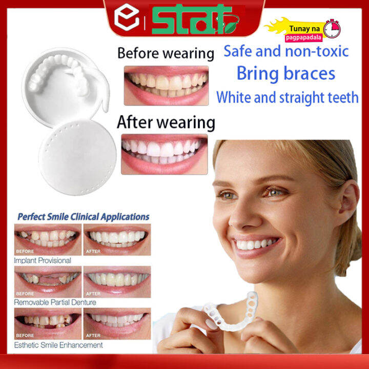 STAT Cosmetic Teeth Bright White Shade Upper + Lower Dental Veneers Set ...