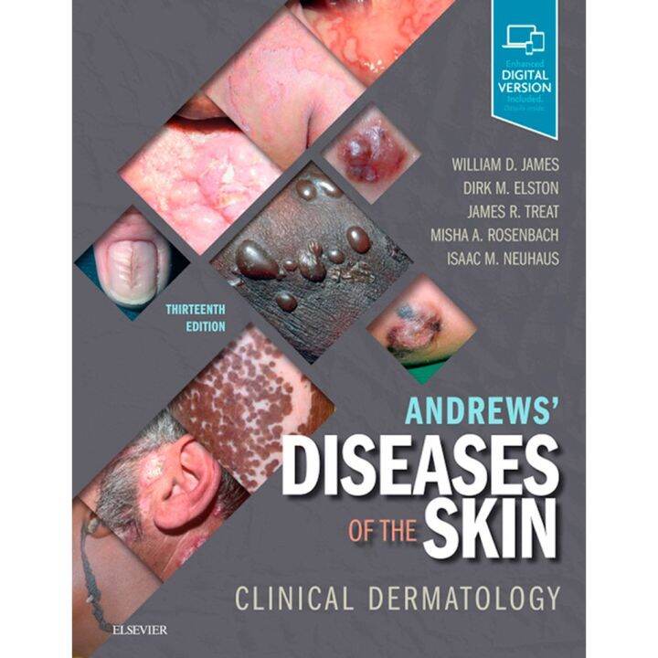 Andrews' Diseases of the Skin: Clinical Dermatology, 13th Edition | Lazada PH