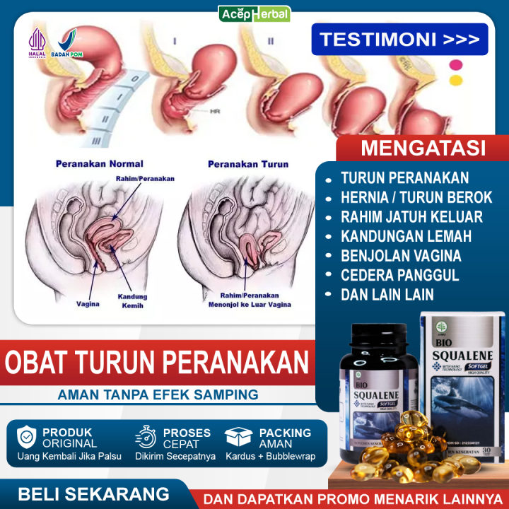 Obat Turun Peranakan Polaps Uteri Turun Rahim Menaikan Peranakan ...