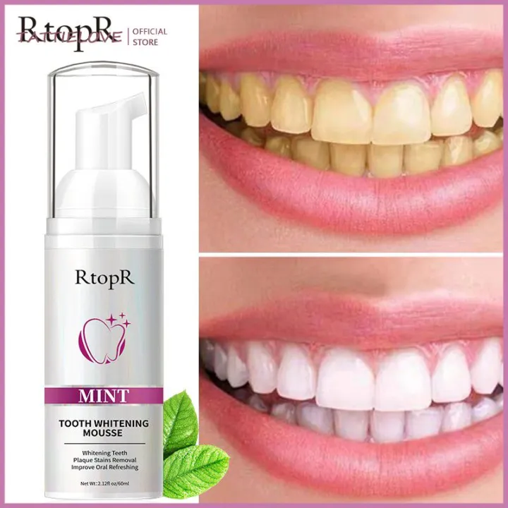 RtopR - Teeth Whit--ening Liquid, Teeth Foam, Stain Remover, Toothpaste ...
