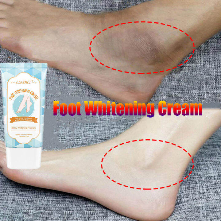 ELAIMEI Foot Whitening Cream Moisturizing Treatment Hydrating Smooth ...