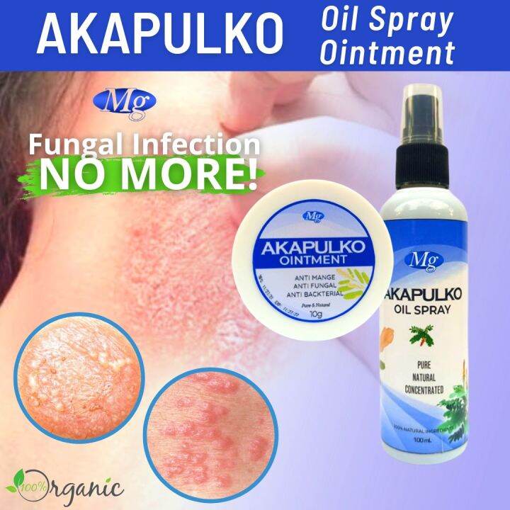 JUST JOY MG AKAPULKO OIL SPRAY 100ML & OINTMENT 10G, ANTI ITCH, ANTI ...