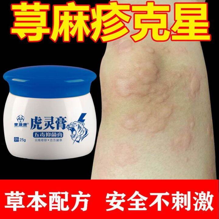 Treatment of acute and chronic urticaria, allergy, wind mass ...