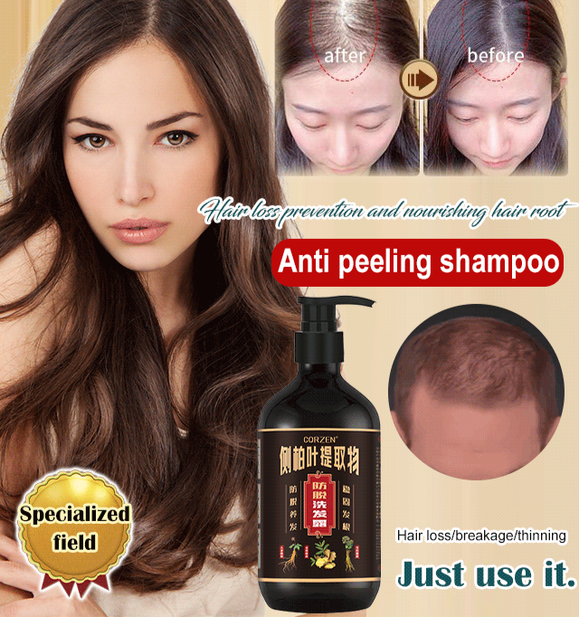 ttpr Ganoderma Ginger Shampoo for Healthy Hair | Lazada PH