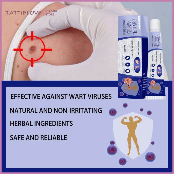 Tattielove south moon Skin Tag Remover Cream- Excess Pimples Warts Acne ...
