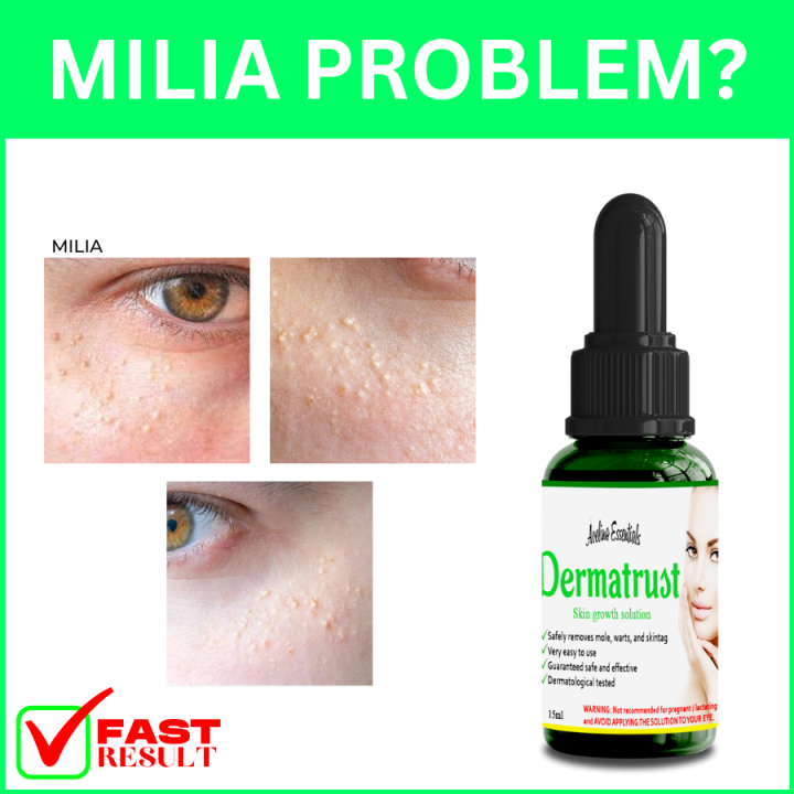 DERMATRUST MILIA REMOVER Skin Growth Remover , milia remover , milia ...