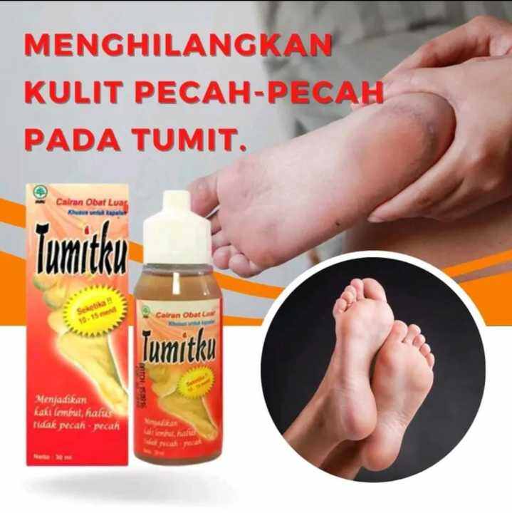 TUMITKU ALAMI SOLUSI UNTUK SEGALA MASALAH TUMIT/MENGHALUSKAN TUMIT ...