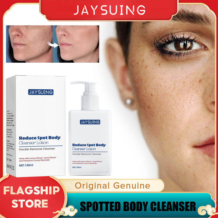 Jaysuing Freckle Cleanser Lotion Reduce Facial Spot Moisturizing Brighten Niacinamide Whitening ...