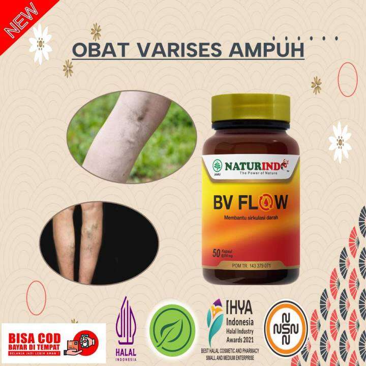 Obat Varises Farises Parises Varises Kaki Varises Betis Pembengkakan ...