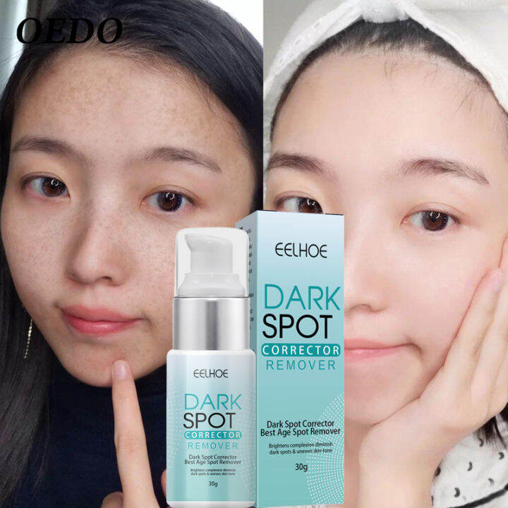 Eelhoe Dark Spot Remover Cream Moisturizing Brighten Improving Uneven Skin Tone Whitening Anti ...