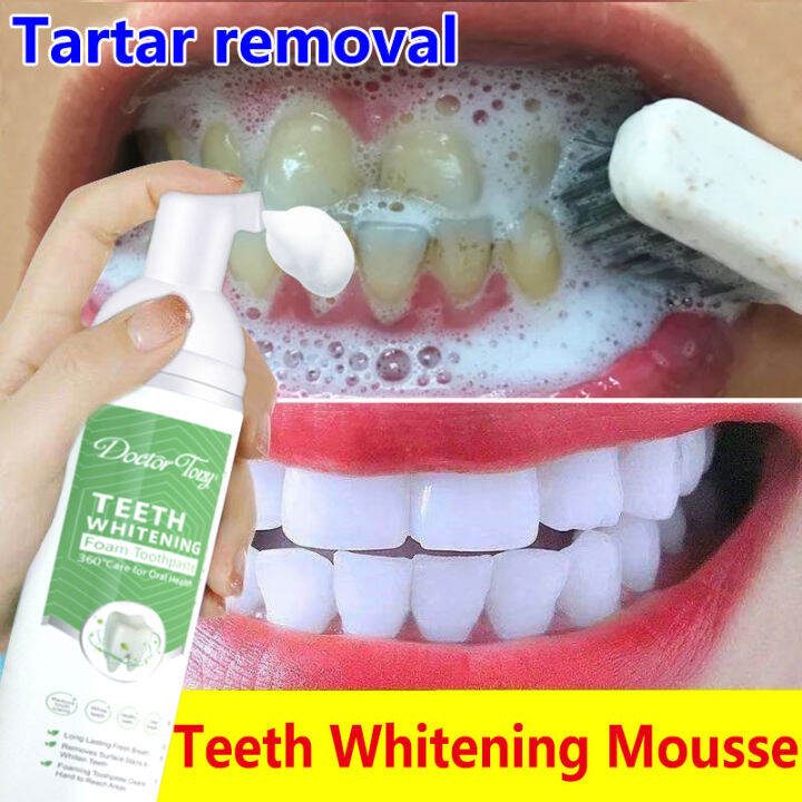 Teeth Whitening Toothpaste Mousse Toothpaste Cleansing teeth Mousse ...