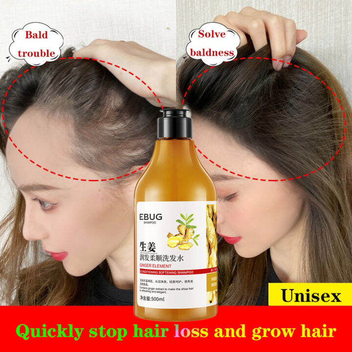 Ginger Hair shampoo Anti Hair Loss Nourish Hair Fast Growth Shampoo Oil Control Anti-Dandruff ...