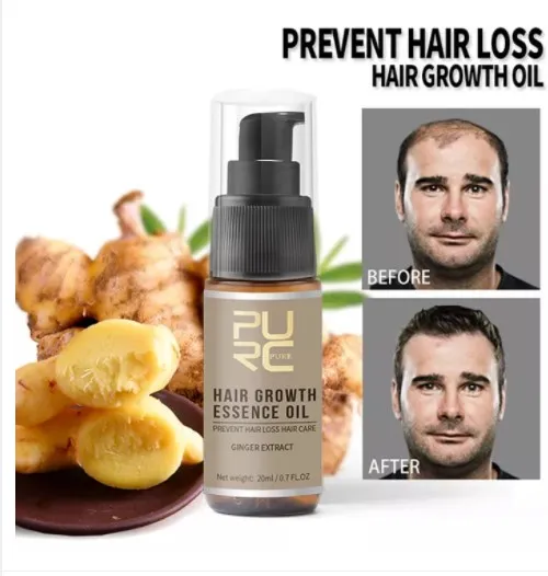 【keepyy】 Purc Hair Growth Spray 30ml Fast Powerful Hair Grower Hair