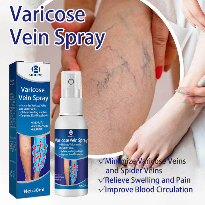 OUHOU Varicose Vein Spray Repair Leg Blood Vessels Bulge Swelling ...