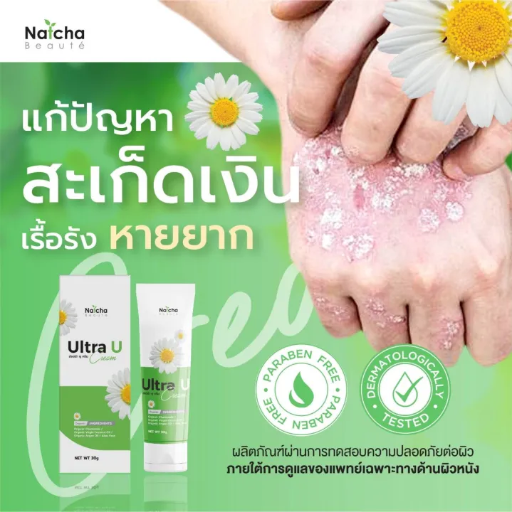 ของแท้ 100% *** นัชชา ณัชชา โบเต้ อัลตร้ายู Natcha Beaute Ultra U ปัญหาผิวลอก ภูมิแพ้ผิวหนัง ผด ...