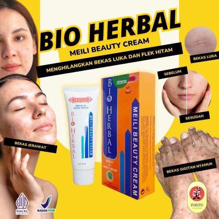 MEILIBAHENLING SALEP BEKAS LUKA BIO HERBAL Original BPOM Memudarkan Bekas Luka | Lazada Indonesia