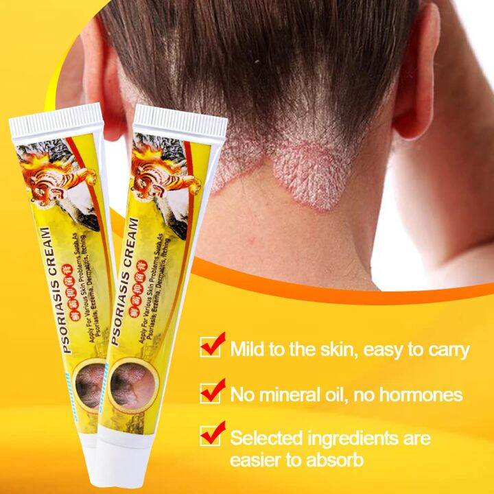 Sumifun Psoriasis Cream,Eczema Cream for Dermatitis, Psoriasis ...