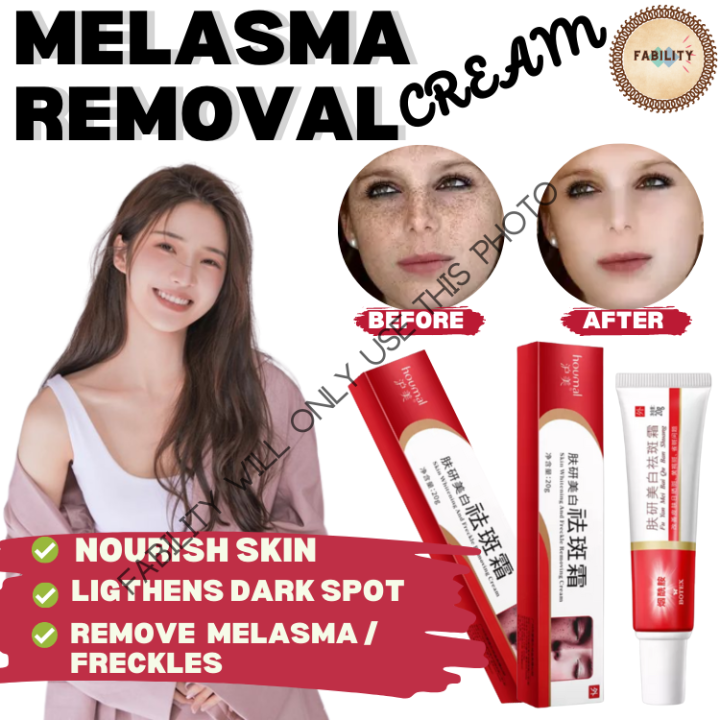 Melasma Cream Pekas Remover Collagen Japan Original Pekas Remover Cream ...