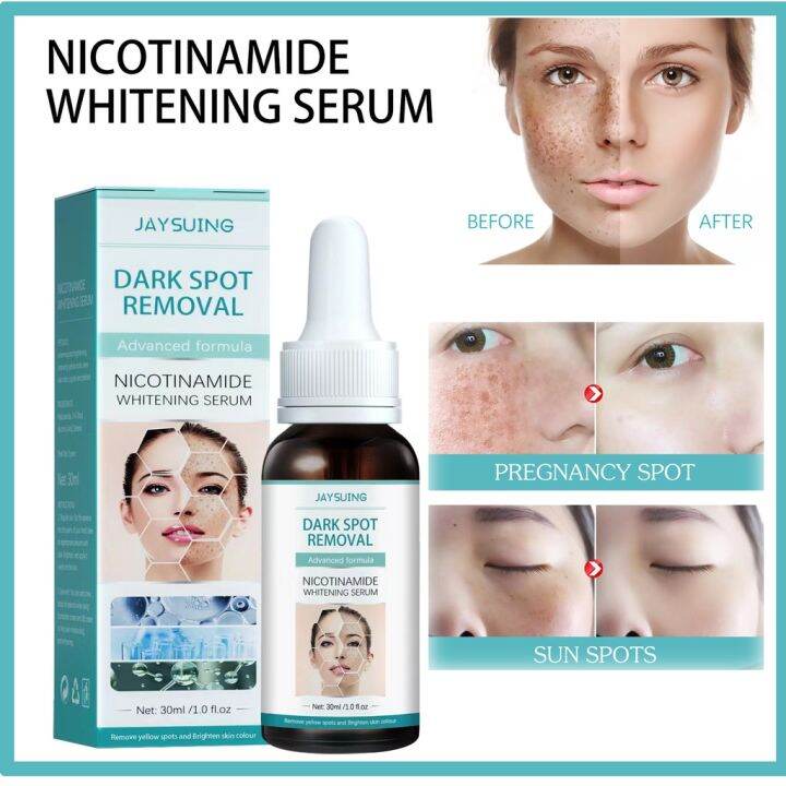Immediate delivery Niacinamide Whitening Serum Freckle removalAnti ...