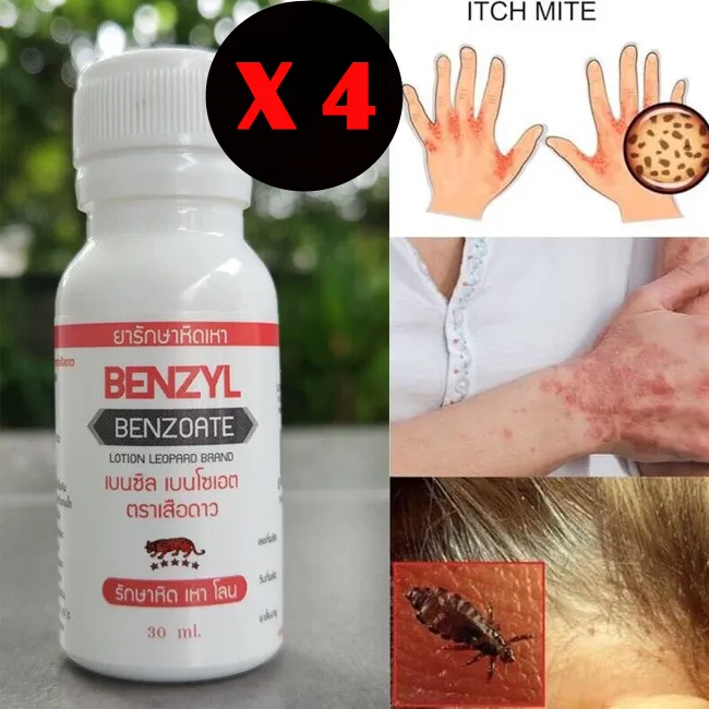 4 SCABIES TREATMENT LOTION MITE & LICE Benzyl Benzoate 25% | Lazada.co.th