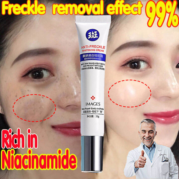 🔥Rich in Niacinamide🔥 anti-freckle whitening cream 20g freckle removal ...