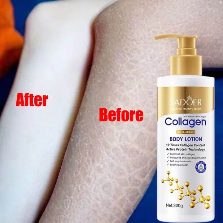 SADOER Whitening Collagen Lotion Body Lotion Pemutih Badan Permanen Bpom Whitening Body Skin ...