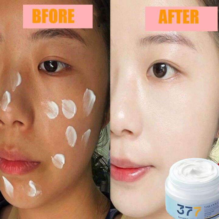 377 Whitening Freckle cream 30g Niacinamide Light Spot Whitening ...