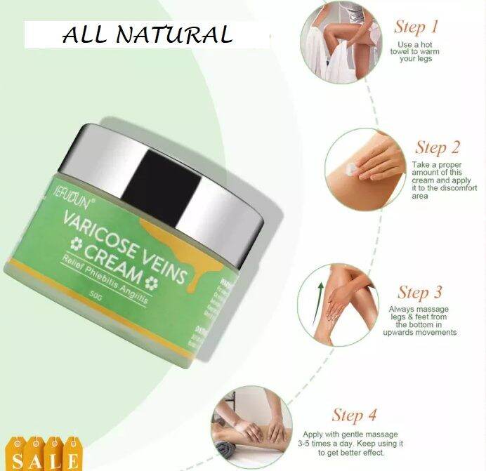 Varicose Vein Cream effective treatment of varicose veins (mahal dahil ...
