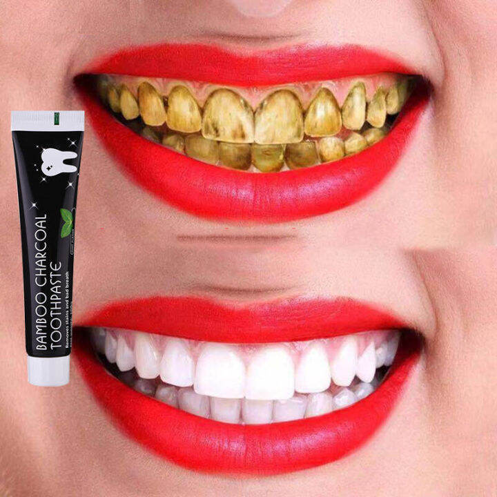 Pei Mei Coconut Whitening Toothpaste Reduce Bad Breath, Remove Yellow ...