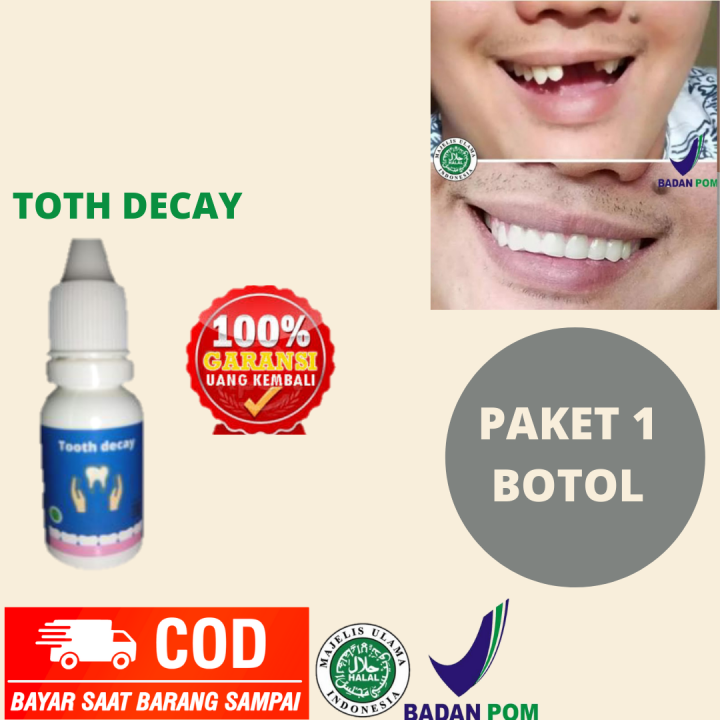 PENUMBUH GIGI ALAMI- Gigi Ompong Tertambal Lagi // Gigi Patah Rapih ...