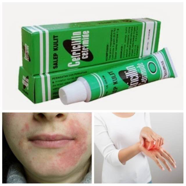 CETRICILLIN Cetrimide Salep Luka Bakar, Luka Ringan & Dermatitis 15 g ...
