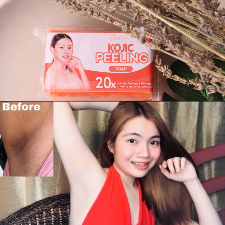Original KOJIC SOAP 150g Instant Whitening 20x Instant Peeling & Whitening Pimple and Scar ...