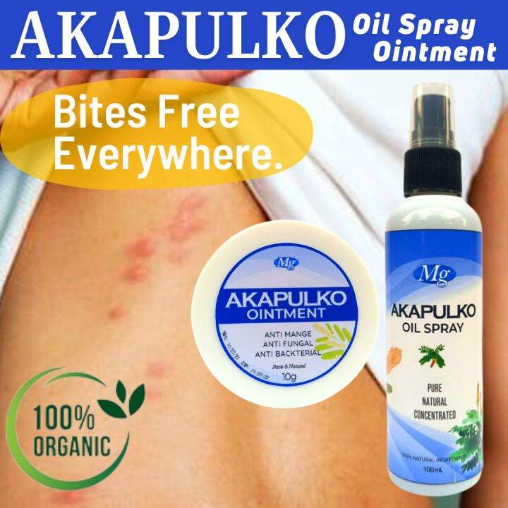 MG AKAPULKO OIL SPRAY 100ML & OINTMENT 10G Allergy Relief Spray: Herbal ...
