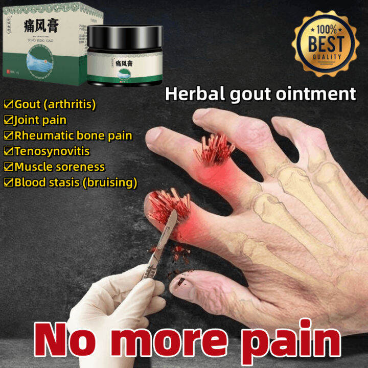 Fast Relief from Gout Pain Gout Ointment Osteoarthritis Joint Pain ...