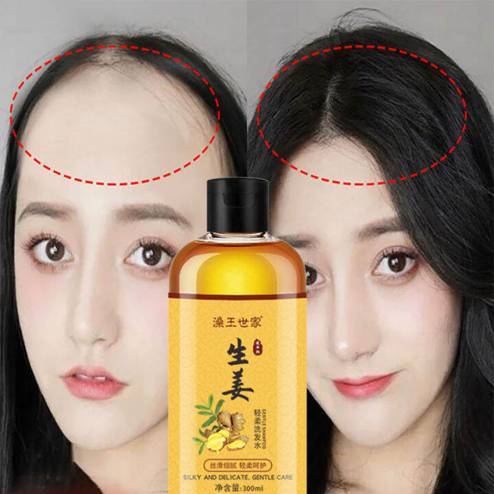 Ginger Shampoo Organic Herbal Essence Recipe Hair Growth Hair Shampoo Treatment Type 300ml