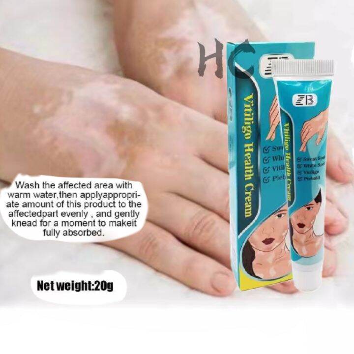 20ml ZB Vitiligo Treatment Cream Sweat Spot Piebald Remove Herbal ...